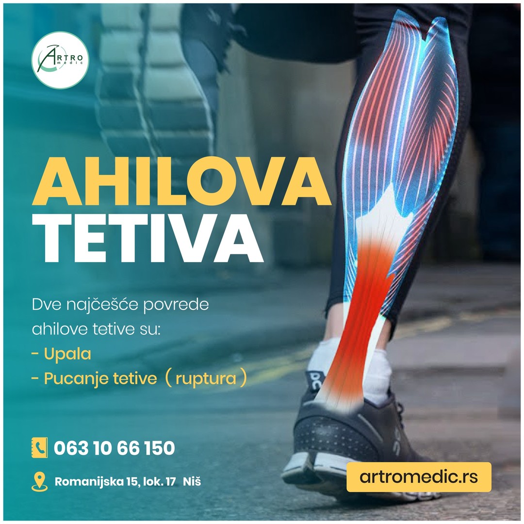 Artro Medic: Ahilova tetiva